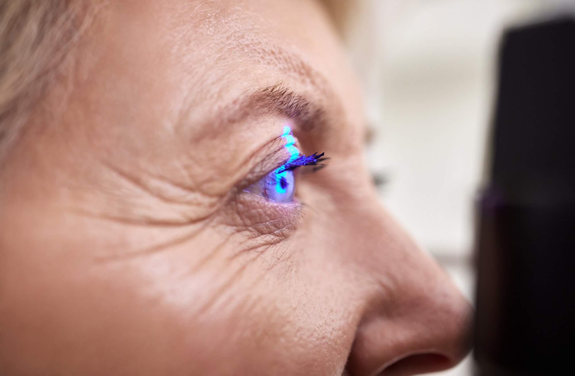 Age-Related Macular Degeneration – RetinaCare of Virginia Medical ...