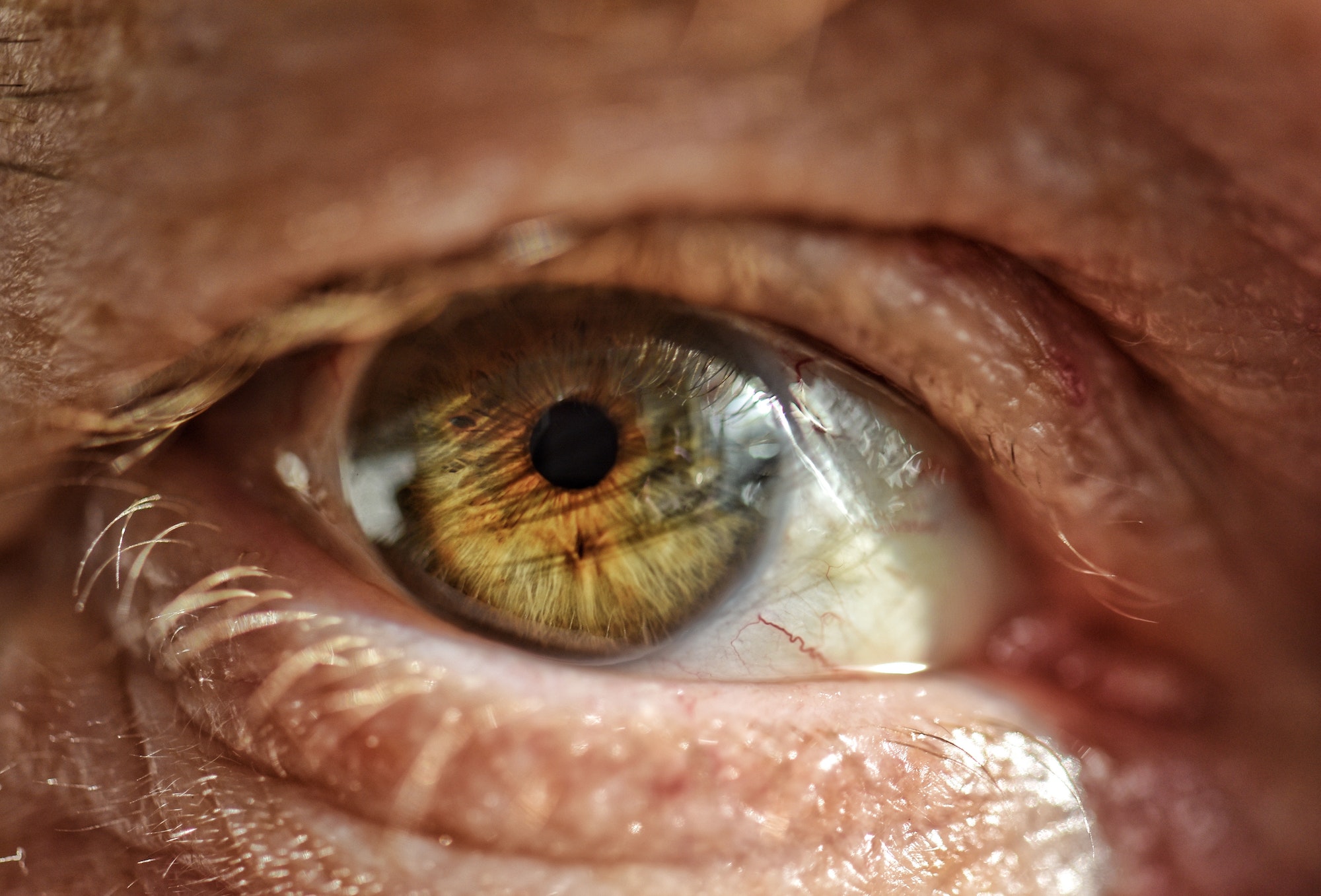Diseases of the Retina – RetinaCare of Virginia Medical & Surgical Care ...